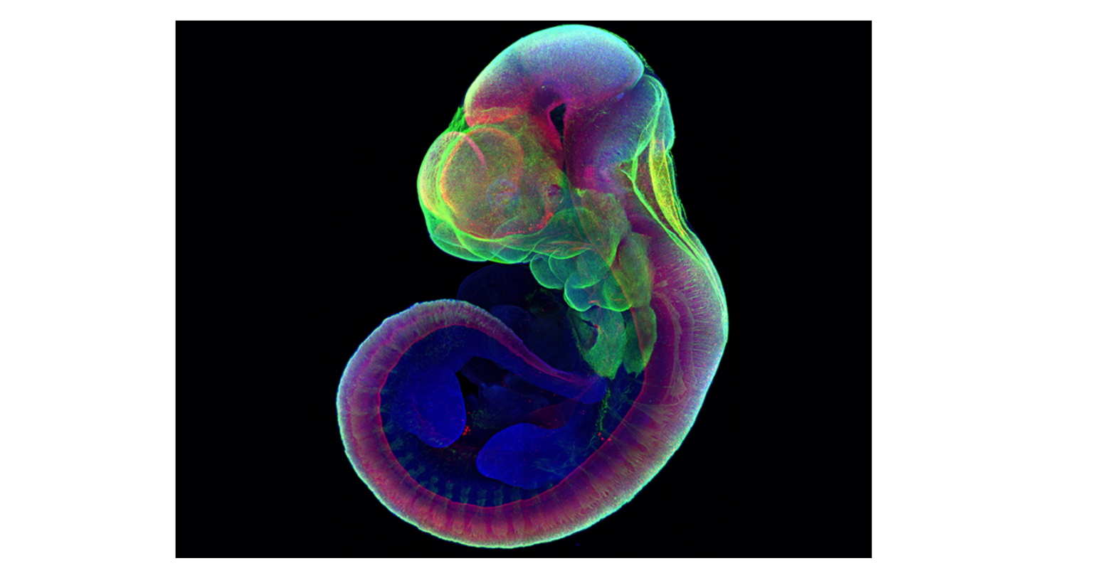 A Mouse Embryo Grown In An Artificial Womb